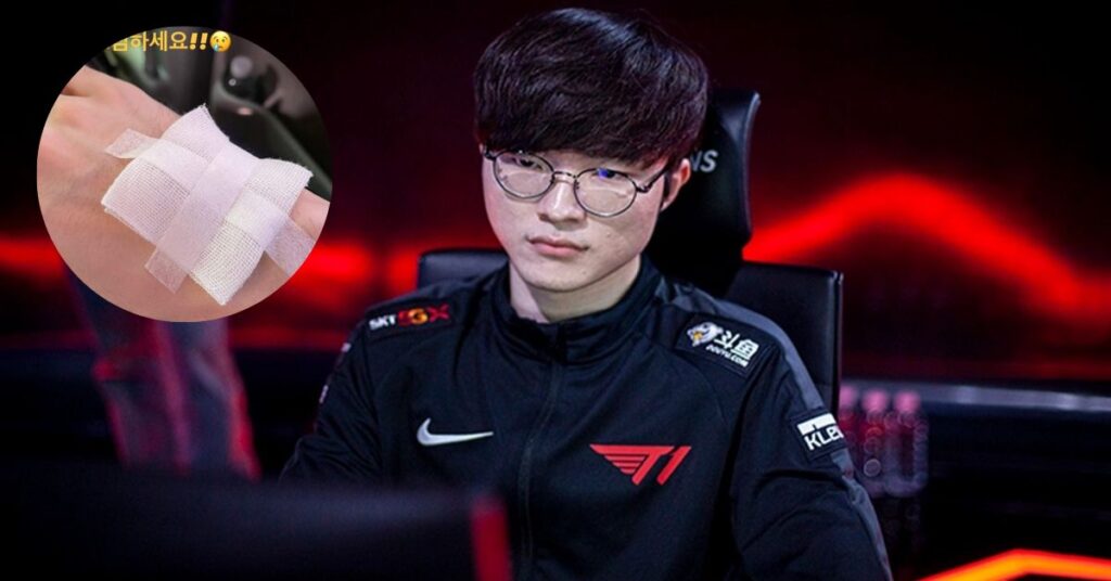 Faker chấn thương, kỳ vọng cho Fan T1 trước ngày đối đầu Gen.G