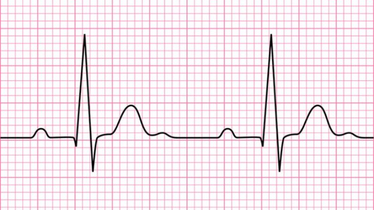 ECG là gì? Dùng để làm gì? Có trên các thiết bị nào?