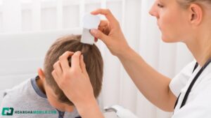 Cách trị chấy: 10 cách hiệu quả, an toàn cho bé và người lớn